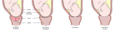 Aastha Maternity And Laparoscopy Centre