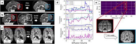 Prequal Performs Artifact Correction A Susceptibility Induced