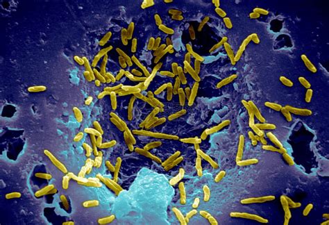 龟分枝杆菌的扫描电子显微照片高清图片下载 正版图片502937120 摄图网