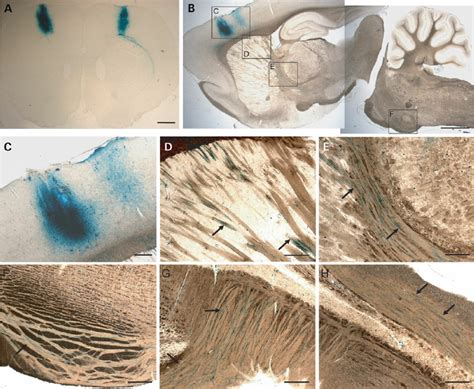 Transduction Of The Adult Sensorimotor Cortex And CST By EIAV LacZ Download Scientific Diagram