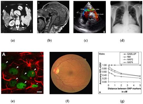 Visual Interpretation Of Convolutional Neural Network Predictions In Classifying Medical Image