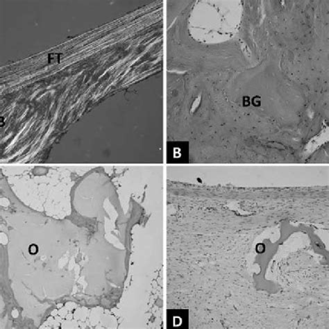 C Free Vascularized Fibular Bone Graft With The Pedicle Of The Download Scientific Diagram