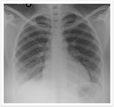 Follow Up X Ray On Week 2 Download Scientific Diagram