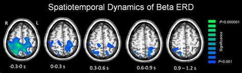 Statistical Parametric Maps Spms Showing The Dynamics Of Beta Download Scientific Diagram
