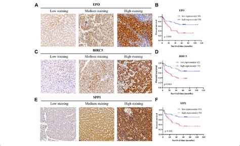 Verification Of The Prognostic Efficiency Of The Three Markers In Hcc