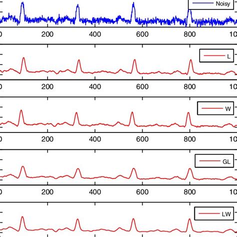 Ecg Signal With A 50 Hz Disturbance Noise And Filtered Signals Using L