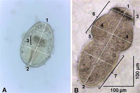 Protoescólices De Echinococcus Granulosus Procedentes De Hígado Humano