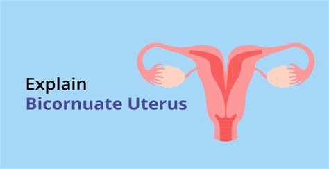 Uterus Didelphys Causes Symptoms And Treatment Birla Fertility And Ivf