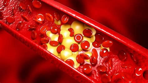 Biggest Mistakes You Make While Trying To Reduce Cholesterol Levels Onlymyhealth