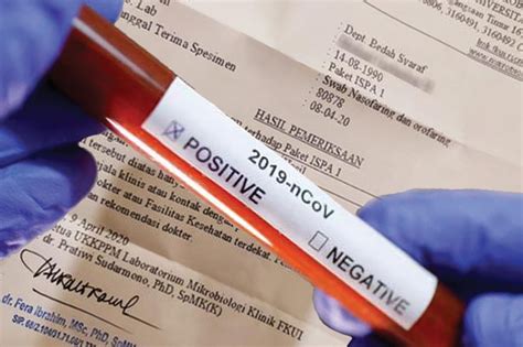 Soal Bukti Uji Swab Pegawai Tuding Sekda Bohong Siwalima