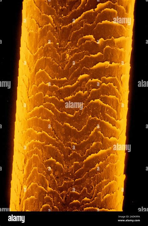 False Colour Scanning Electron Micrograph Sem Of A Single Shaft Of Human Hair Hair Consists