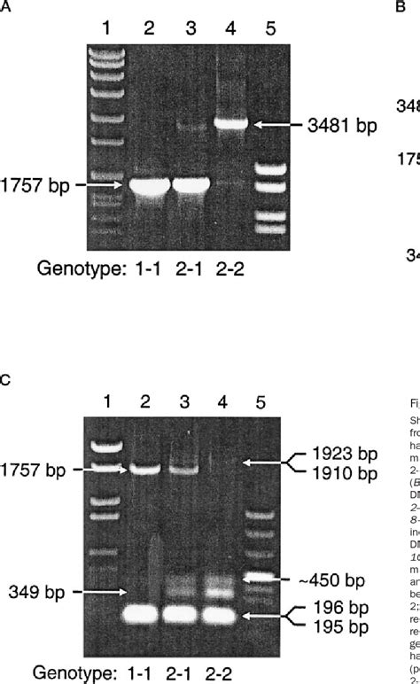 Figure 1 From Genotyping Of The Common Haptoglobin Hp 1 2 Polymorphism Based On Pcr Semantic
