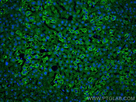 Apob Antibody 84047 1 Pbs Proteintech