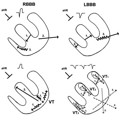 Schematic Explanation Of The Rationale Behind The Avr Vereckei Download Scientific Diagram
