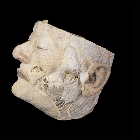 M Zygomaticus Minor Präpapp Early Access