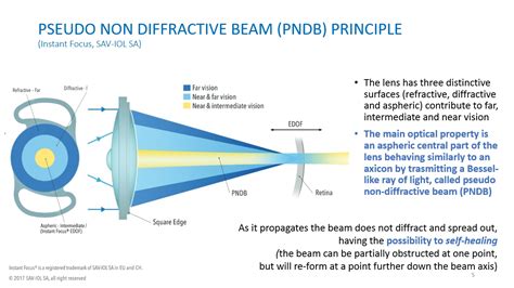 Escrs Optical Principles And Light Theories Of The Actual Edof Iol