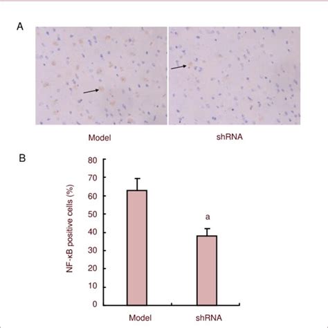 Expression Of Nuclear Factor Kappa B Nf κb Mrna A Quantitative