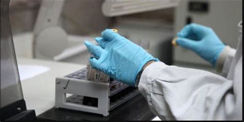 Tuberculosis On The Rise Who Is At Risk Rwanda