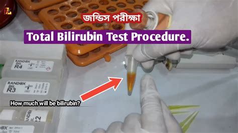 Total Bilirubin Test Procedure Youtube