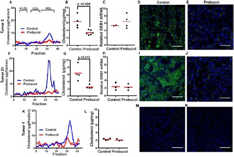 Figure 1 From Uptake Of Hdl Cholesterol Contributes To Lipid Accumulation In Clear Cell Renal