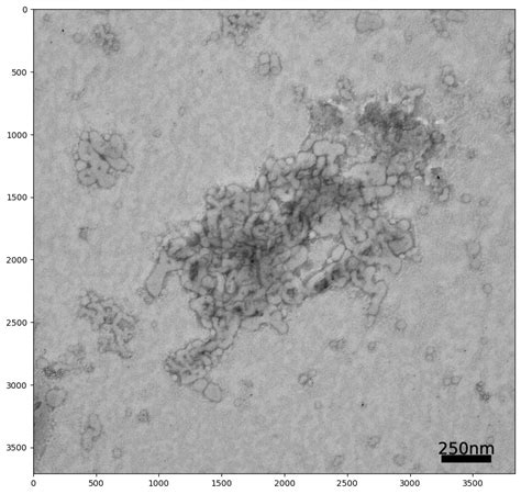 Micrograph Analysis Tutorial — Simplipytem 108 Documentation