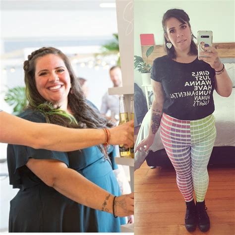 9 Months Post Gastric Sleeve Surgery Album On Imgur