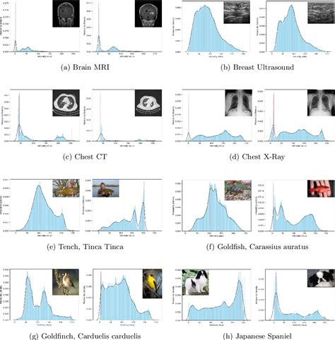 Adversarial Robust Transfer Learning For Medical Imaging Via Domain Assimilation