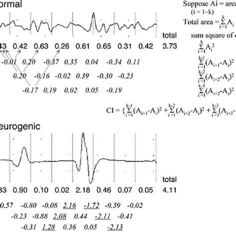 Pdf Standards For Quantification Of Emg And Neurography