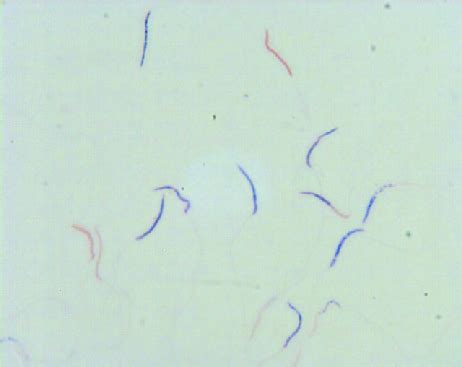 Gram Staining Of Sperm Cells To Reveal Chromatin Condensation Status Download Scientific