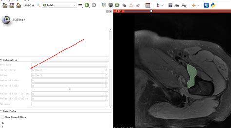 肌肉面积测量 问题求助 3dslicer中文论坛
