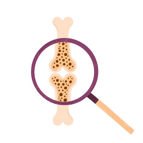 Premium Vector World Osteoporosis Day Poster About Osteoporosis