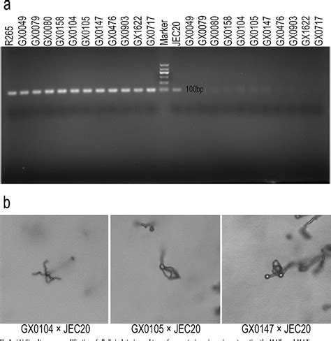 Figure 1 From Emerging Cryptococcus Gattii Species Complex Infections In Guangxi Southern China