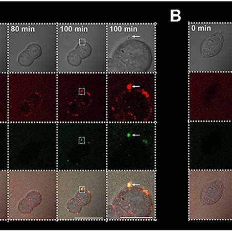 The Colocalization Of The R11 Component Red And The Dna Green