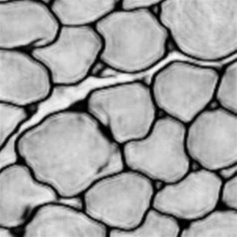 Qualitative Comparison Between Learned Random Walker And Watershed Download Scientific Diagram