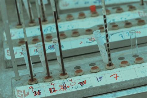 Understanding The Different Types Of Blood Tests And Their Significance The Reporter Desk