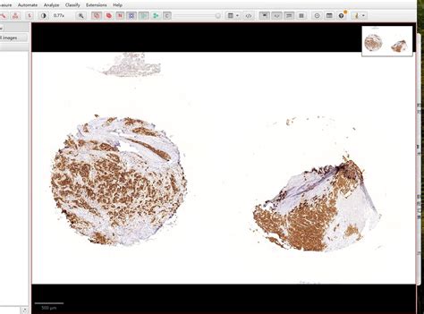 openslide and qupath pixelation and background color abnormality in
