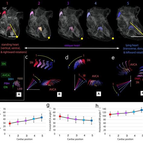 The Anatomy And Histology Of The Human Sinus Node A The Exposed Download Scientific Diagram