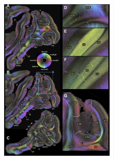 Fiber Orientation Maps Of Sagittal Sections Through The Left Hemisphere Download Scientific