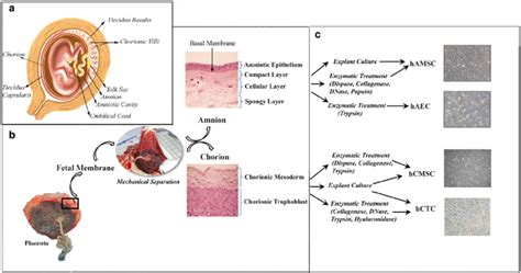 1 Placenta Structure And Placenta Derived Cells A Illustration Of