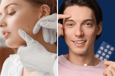 Are Pimple Patches Recommended By Dermatologists