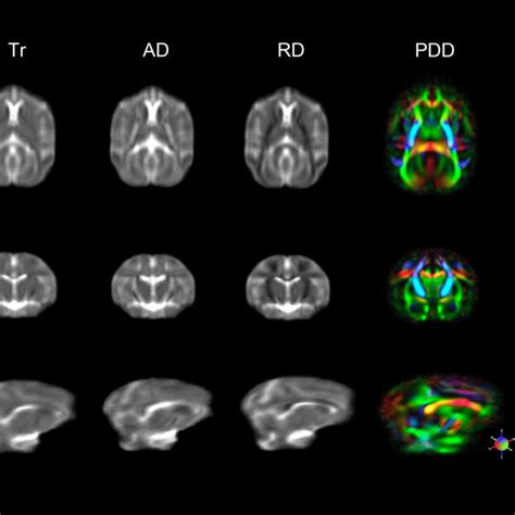 Dti Template The Respective Metric Maps Of The Dti Template Include