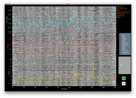 Visualqc Gallery Functional Mri Scan Artefact Detection And Rating