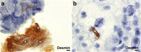 Desmin Ihc Staining In Spread Fetal Tissue A Group Of Desmin Positive