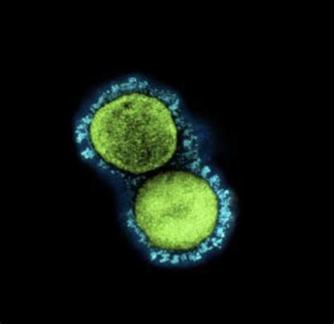 Scientists Identify Interferon Gamma As Potential Sars Cov 2 Antiviral The Transmission