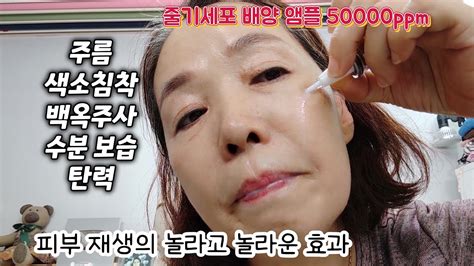 주문폭주 주름 미백 탄력 피부재생의 줄기세포 배양앰플 ppm 이렇게 바르셔야 효과 YouTube