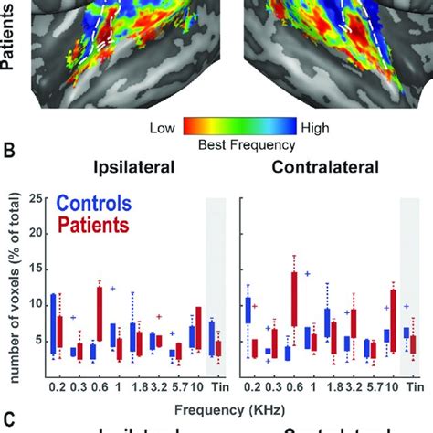 Tonotopy And Tuning Curves In The Auditory Cortex A Tonotopic Map In Download Scientific