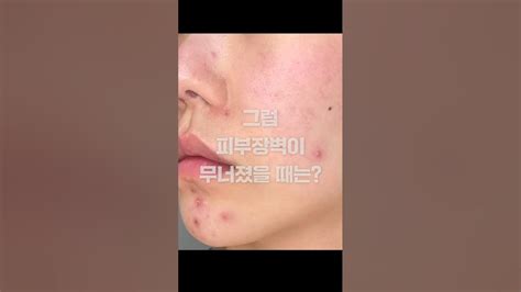 🚨피부 장벽 케어🚨가 진짜 중요합니다 Ft약국템 Youtube