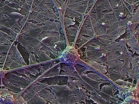 Brain Nerve Cells Sem Stock Image C016 7151 Science Photo Library