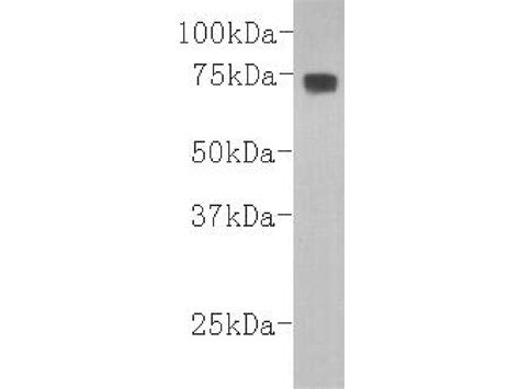 Complement C3β Chain Mouse Monoclonal Antibody 11 10 M0809 14 Huabio