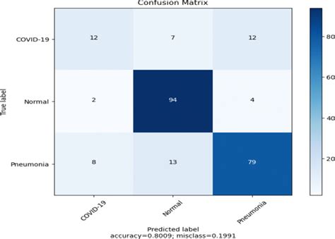 confusion matrix of the model fig 5 using pre trained